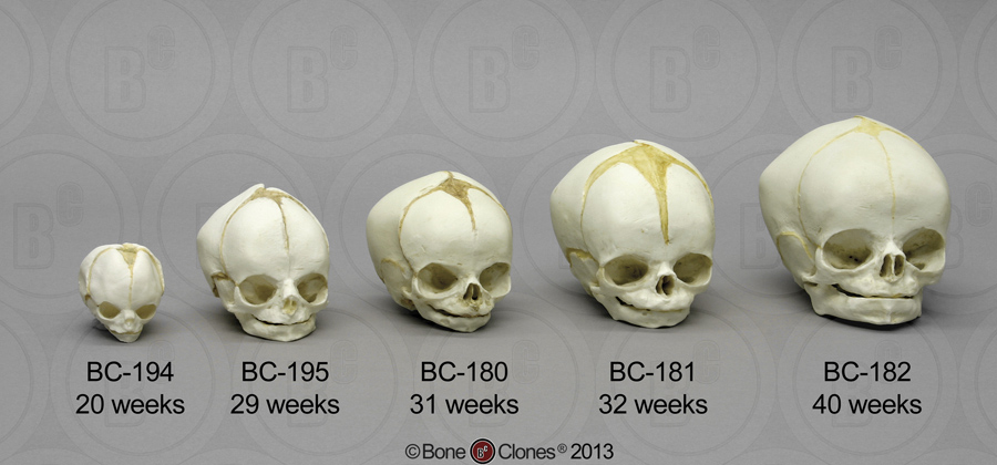 Human Fetal Skull Set of 5 Skulls - Bone Clones, Inc. - Osteological ...