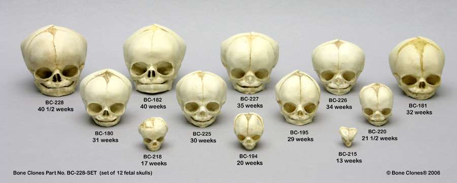 Human Fetal Skulls Set of 12 - Bone Clones, Inc. - Osteological ...