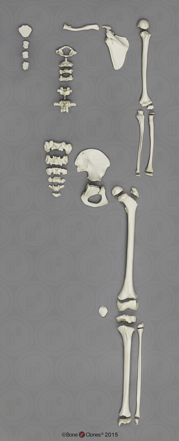Human European American Male 13-year-old Partial Skeleton - Bone Clones ...