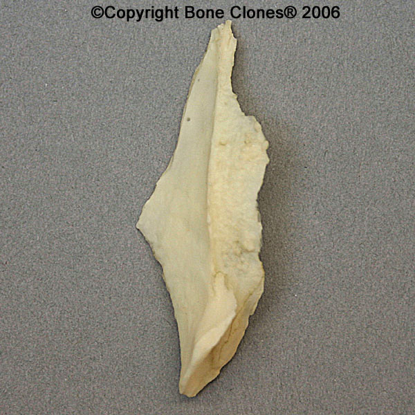 Lacrimal Bone Disarticulated
