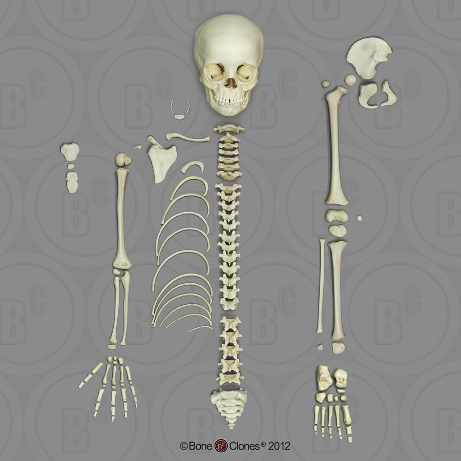 5-year-old Human Child Skull with Mixed Dentition Exposed & Calvarium ...